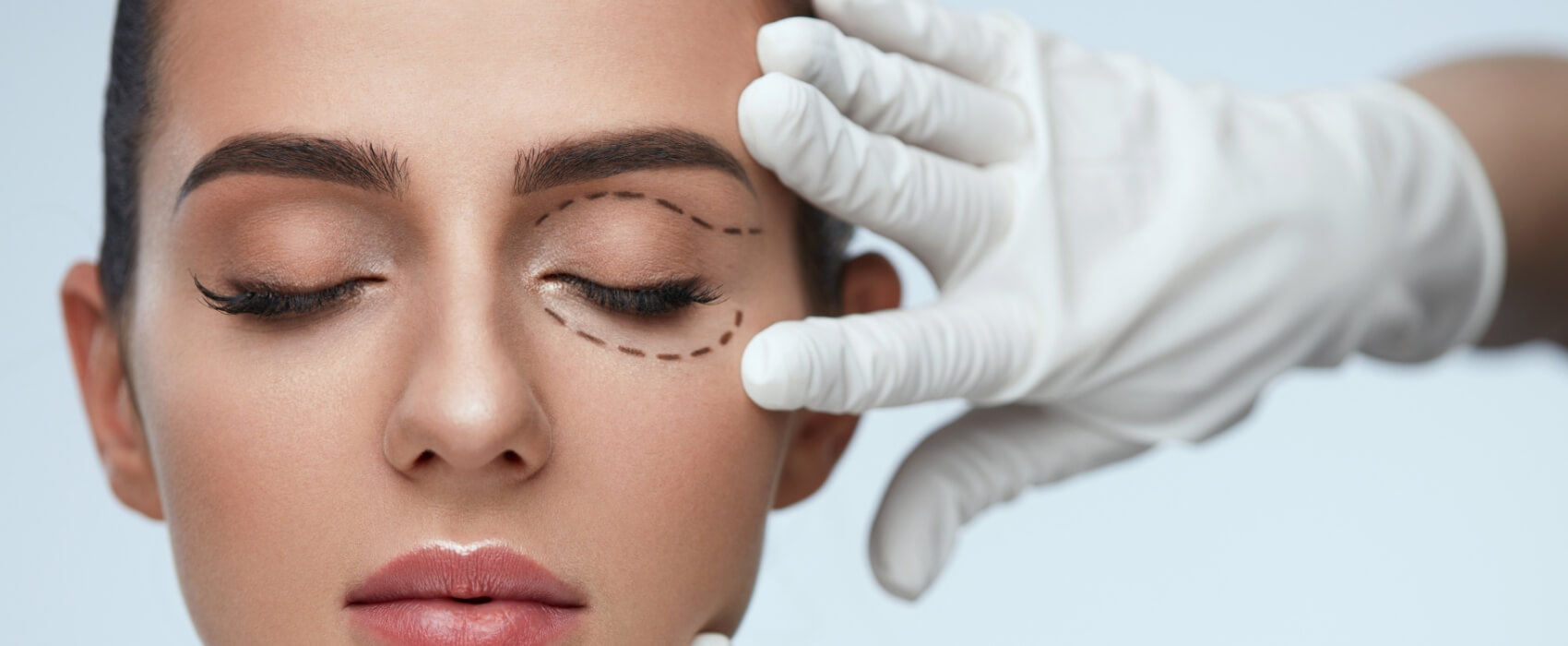 Blepharoplasty Perth - Eyelid Surgery WA - Rodin Clinic
